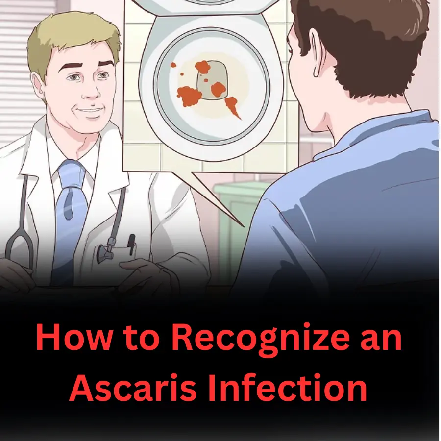 How to Recognize an Ascaris Infection