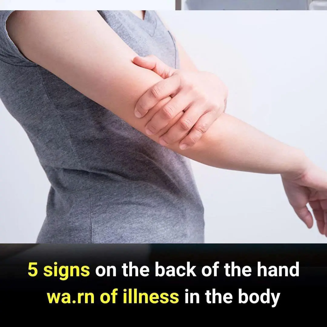 What the Back of Your Hand Can Reveal About Your Health: 5 Signs to Watch