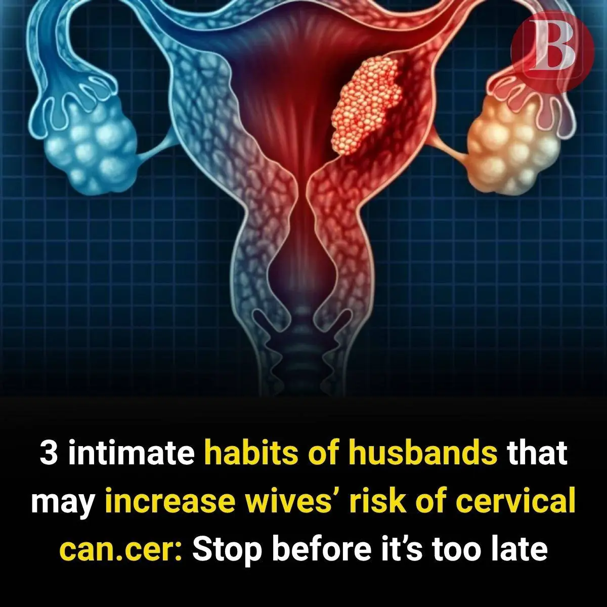 Three Intimate Habits of Husbands That May Increase Their Wives’ Risk ...